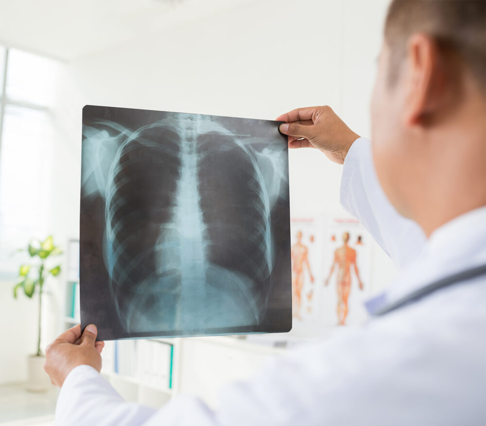 Salt therapy – Halo Generators